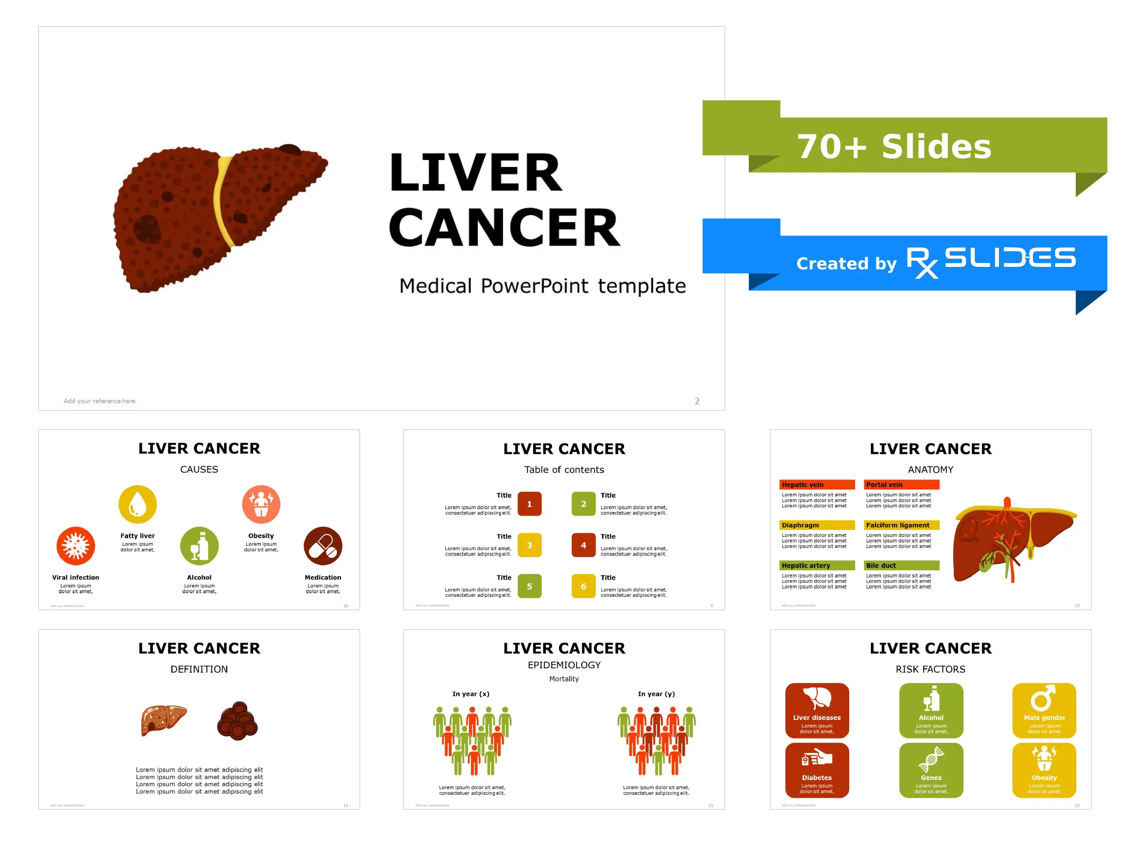 Download liver Cancer PowerPoint Template|